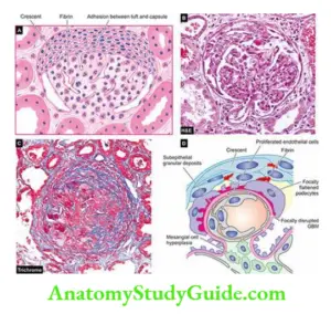 The Kidney And Lower Urinary Tract Pathology Notes - Anatomy Study Guide