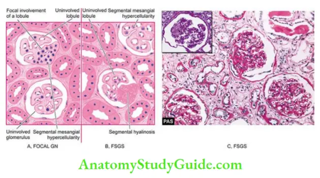 The Kidney And Lower Urinary Tract Pathology Notes - Anatomy Study Guide