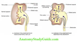 The Kidney And Lower Urinary Tract Pathology Notes - Anatomy Study Guide