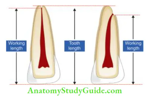 Working Length Determination Notes - Anatomy Study Guide
