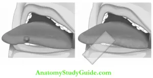 Pigmented Lesions Of Oral Mucosa Short Notes - Anatomy Study Guide