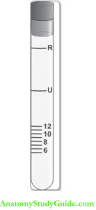 Urine Ketone Bodies And Bile Salts Analysis Pathology Notes - Anatomy ...