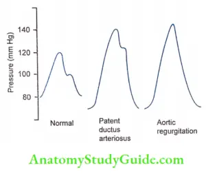 Arterial Pulse Physiology Notes - Anatomy Study Guide