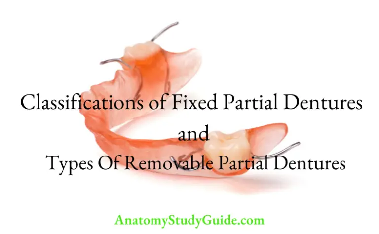 Classifications of Fixed Partial Dentures and Types Of Removable ...