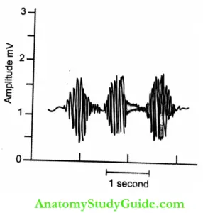 Electromyogram And Disorders Of Skeletal Muscle Notes - Anatomy Study Guide