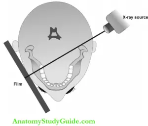 Extraoral Radiographic Techniques - Anatomy Study Guide