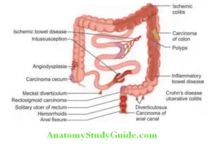 Gastroenterology Question And Answers - Anatomy Study Guide