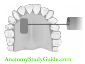 Intraoral Radiographic Techniques - Anatomy Study Guide