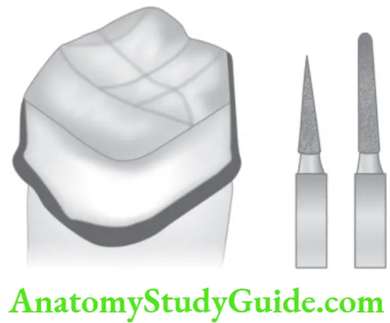 Advantages and Disadvantages of Dental Crown Materials - Anatomy Study ...