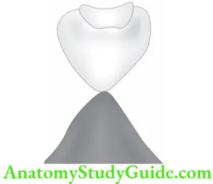 Pontics Design in Fixed Partial Denture - Anatomy Study Guide