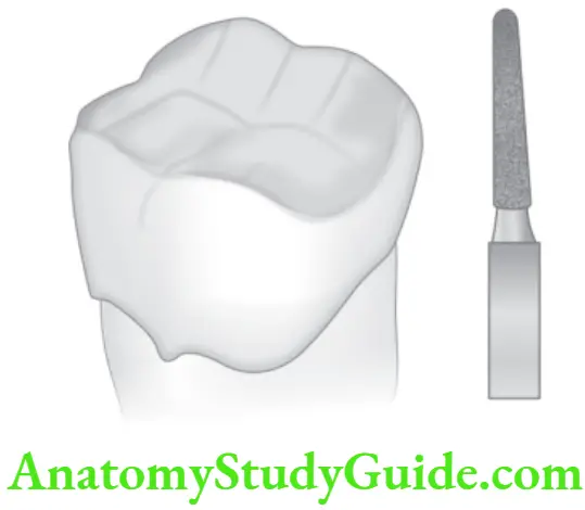 Advantages and Disadvantages of Dental Crown Materials - Anatomy Study ...