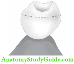 Pontics Design in Fixed Partial Denture - Anatomy Study Guide