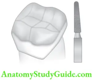 Advantages and Disadvantages of Dental Crown Materials - Anatomy Study ...