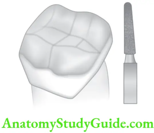 Advantages and Disadvantages of Dental Crown Materials - Anatomy Study ...