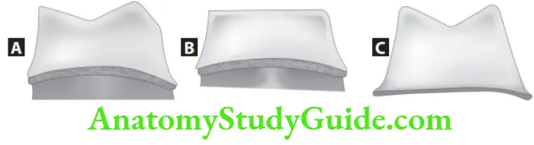 Treatment Planning For The Single-Tooth Short Question And Answers ...