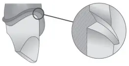 Treatment Planning For The Single-Tooth Short Question And Answers ...