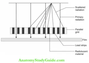 Radiology X-Ray Film And Screens Short Notes - Anatomy Study Guide