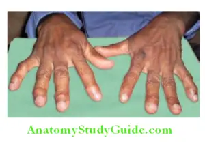 Rheumatology and Connective Tissue Disorders - Anatomy Study Guide