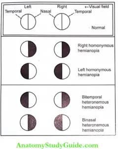 Visual Pathway Introduction Physiology Notes - Anatomy Study Guide