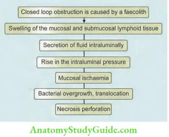 Acute Appendicitis Appendix Anomalies Gastrointestinal Surgery Notes ...