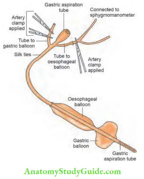 Pyogenic Liver Abscess Portal Hypertension of liver Notes - Anatomy ...