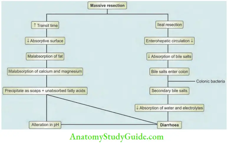 Short Gut Syndrome Causes and Treatment - Anatomy Study Guide