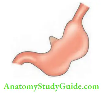 Peptic Ulcer Disease Types, Causes, Treatment - Anatomy Study Guide